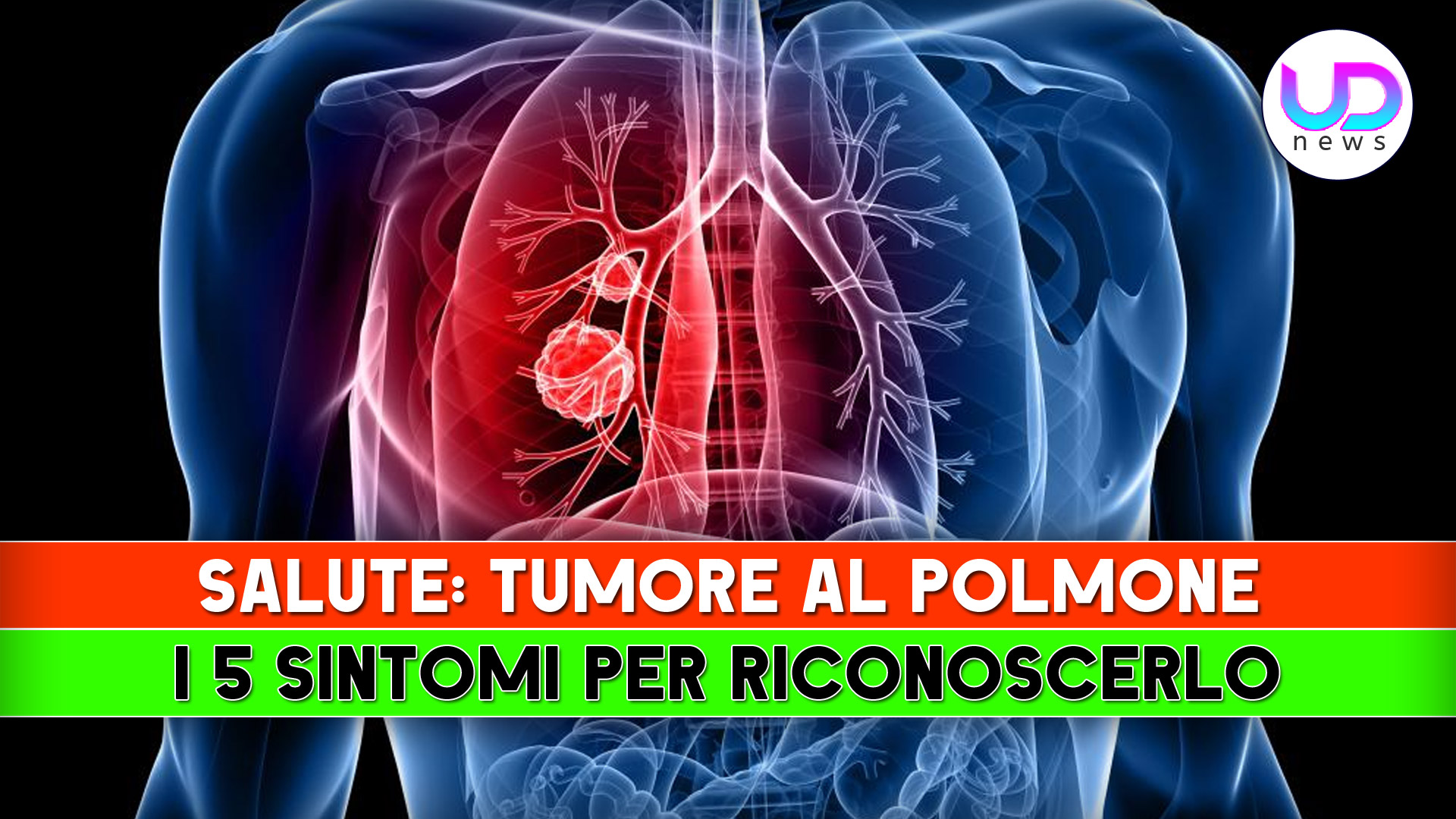 Tumore Al Polmone Ecco I 5 Sintomi Per Riconoscerlo Ud News
