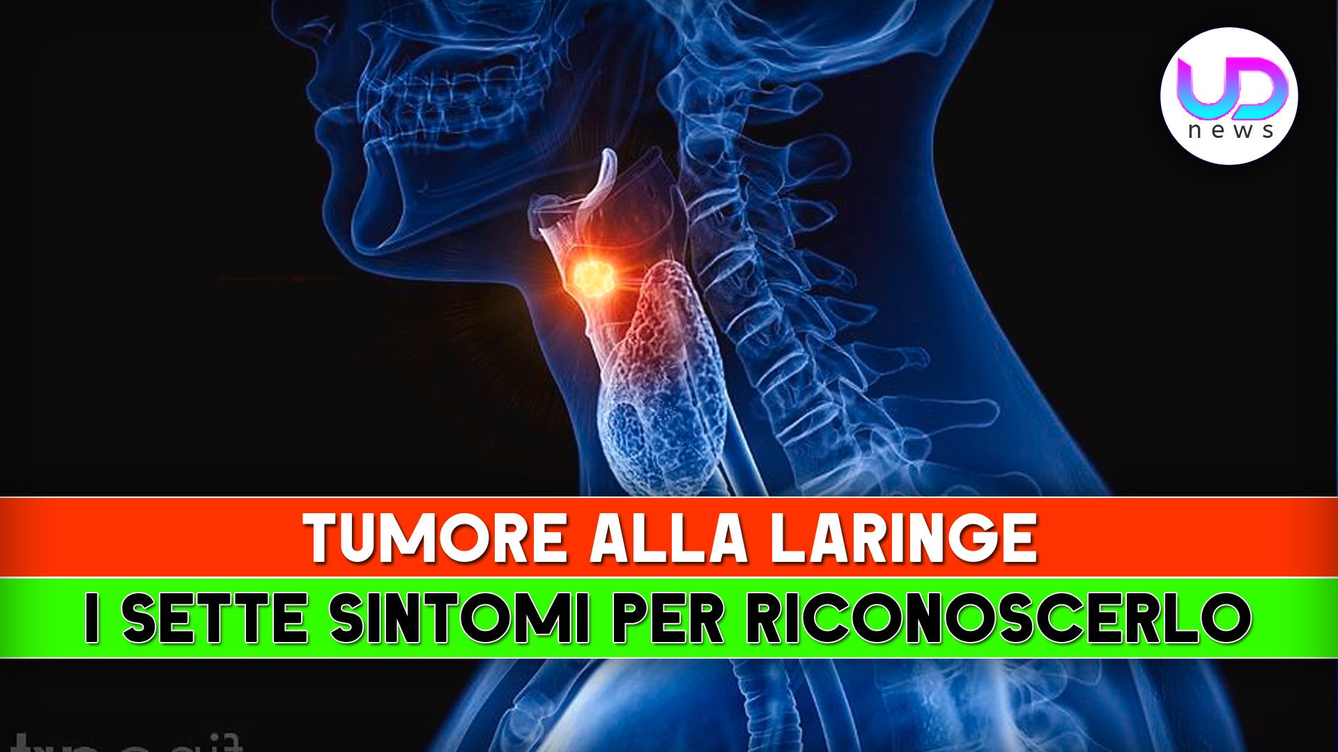 Tumore Alla laringe: I Sette Sintomi Per Riconoscerlo!