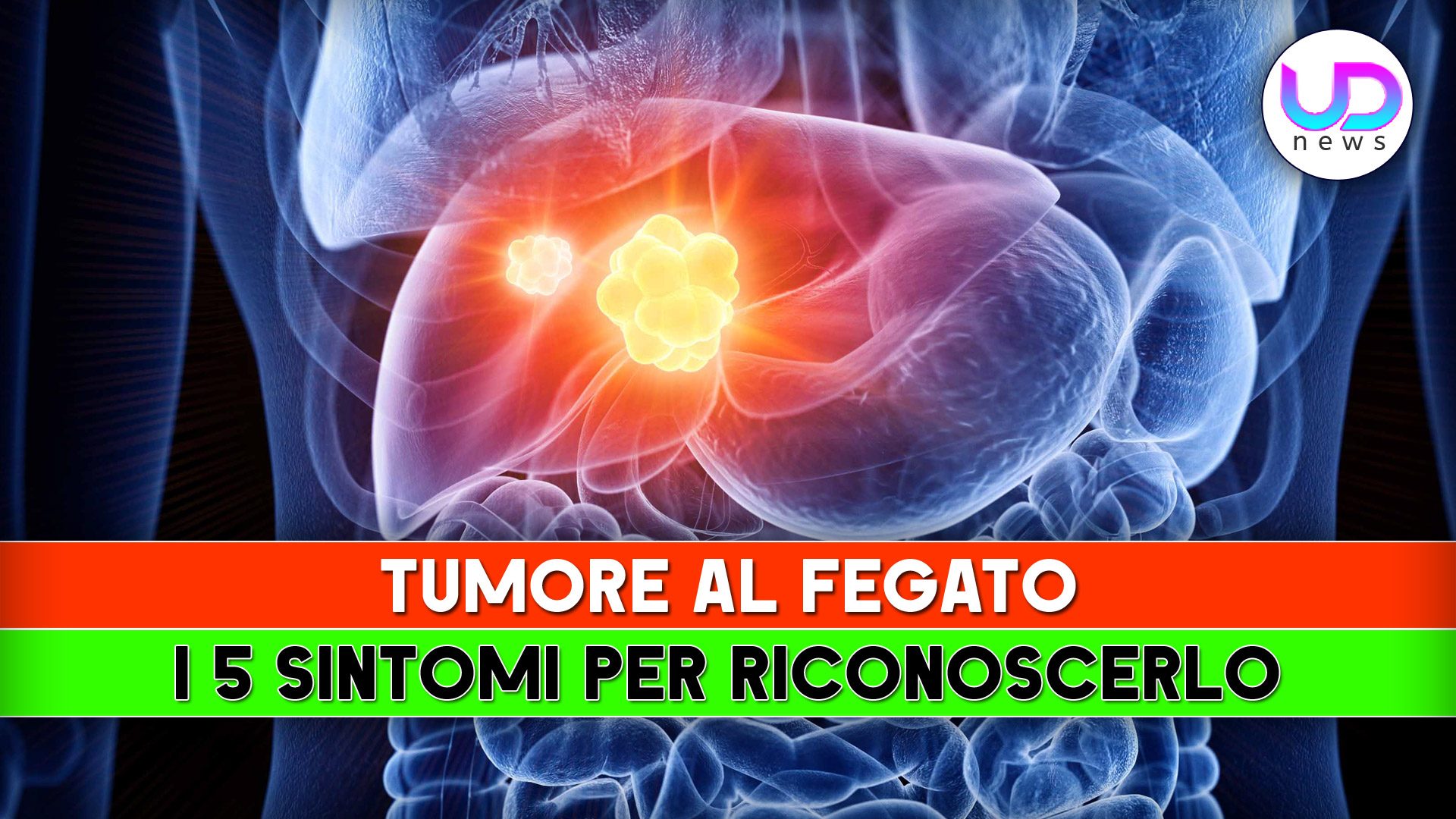 Tumore Al Fegato | I 5 Sintomi Per Riconoscerlo!
