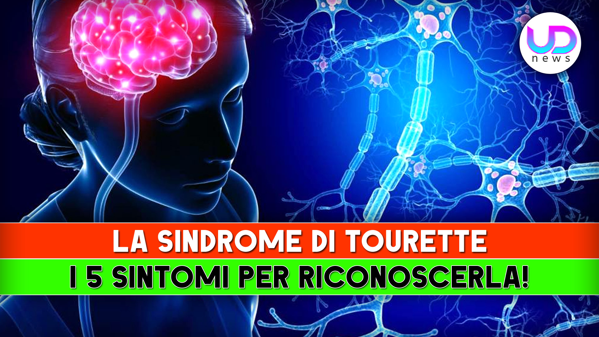 Sindrome Di Tourette: I 5 Sintomi Per Riconoscerla! - UD News