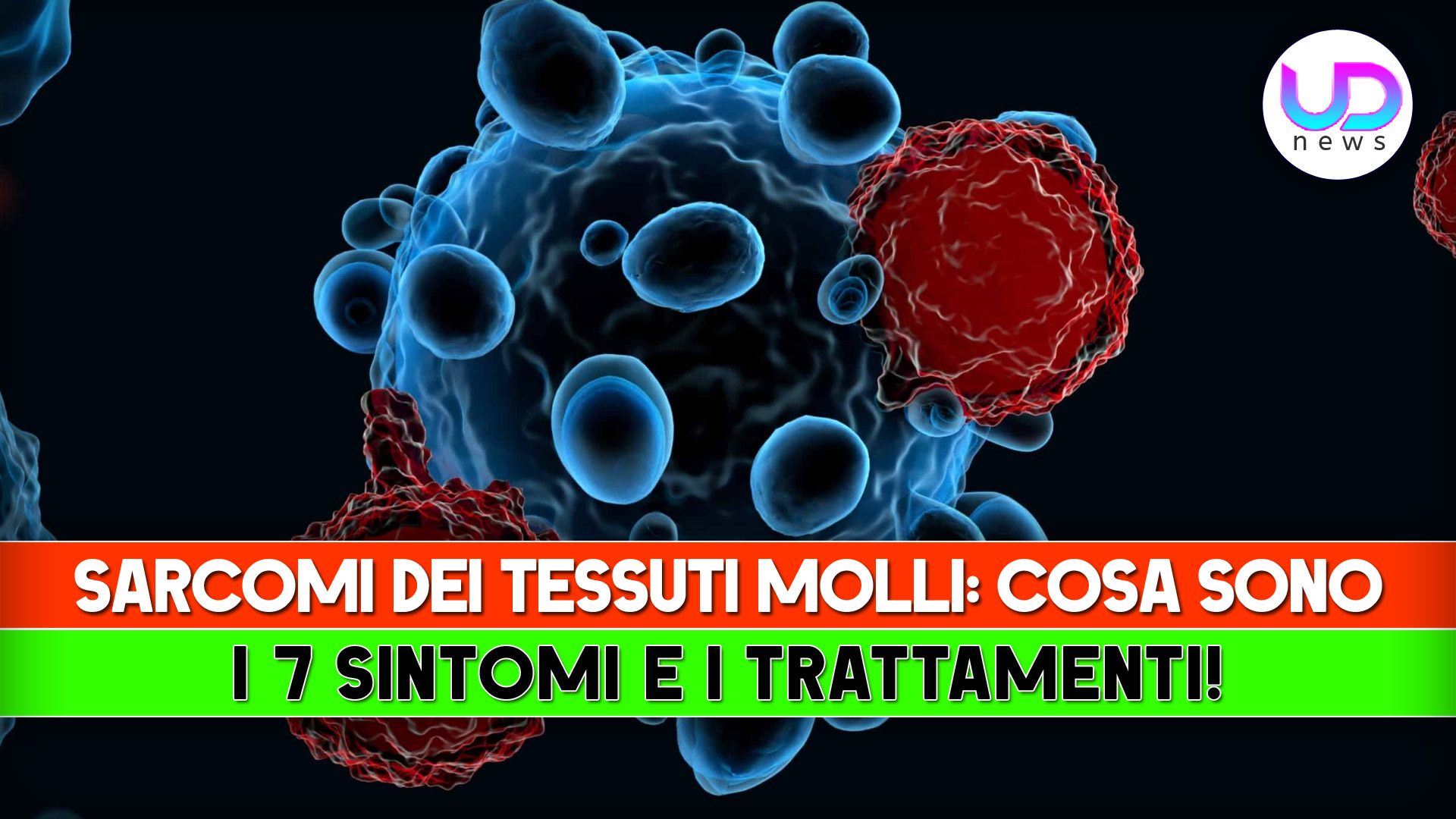 Sarcomi dei Tessuti Molli: Cosa Sono, I 7 Sintomi e Trattamenti!